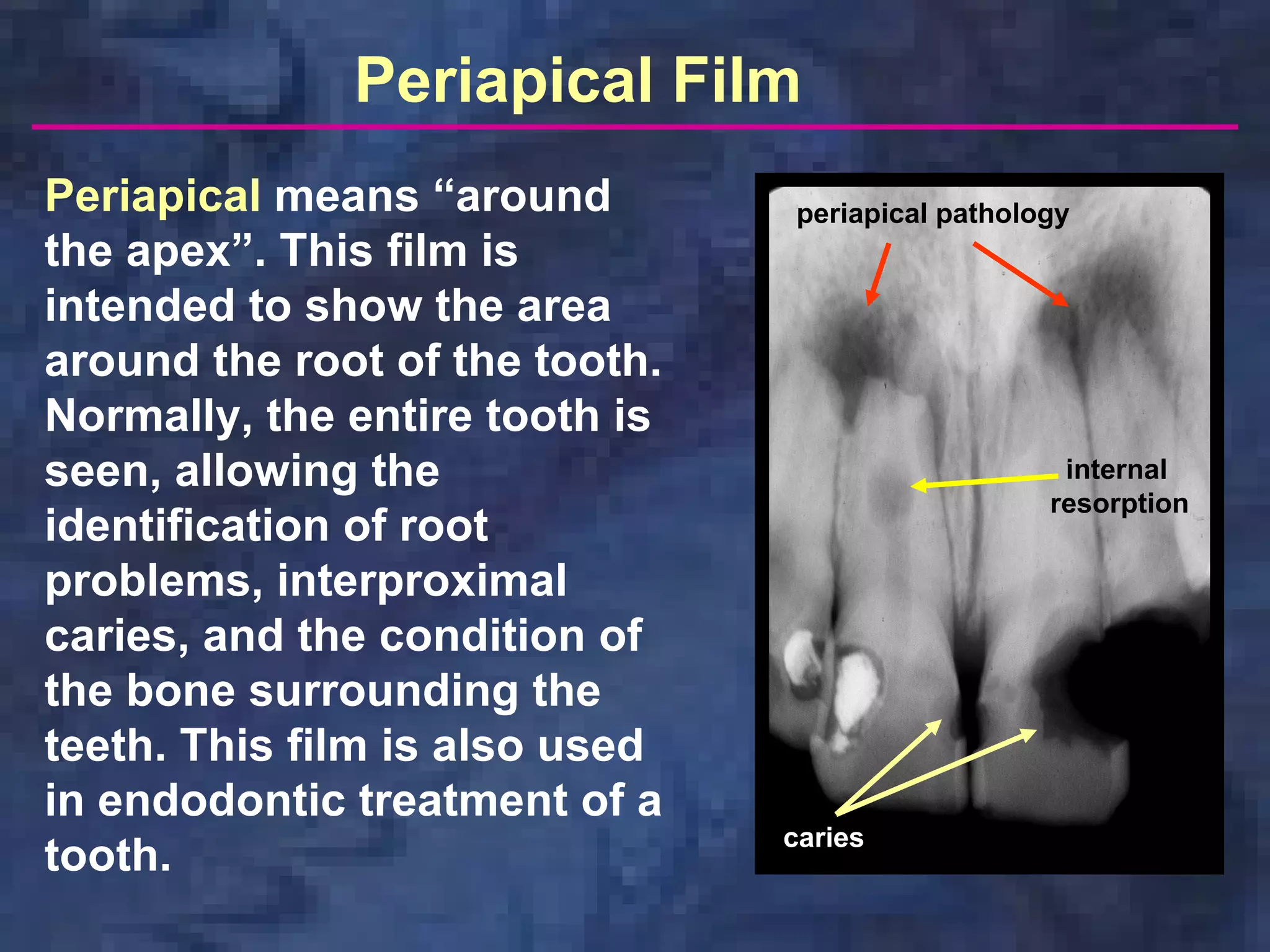 radiology-x-ray film & screens | PDF