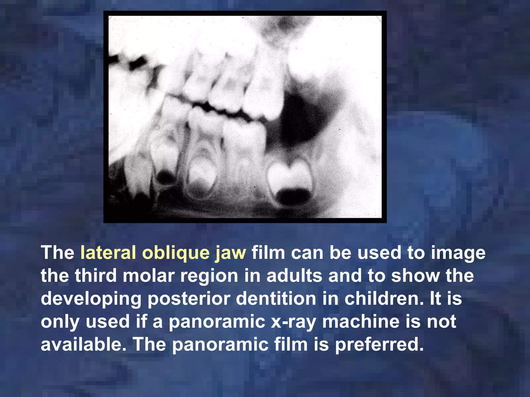 radiology-x-ray film & screens | PDF