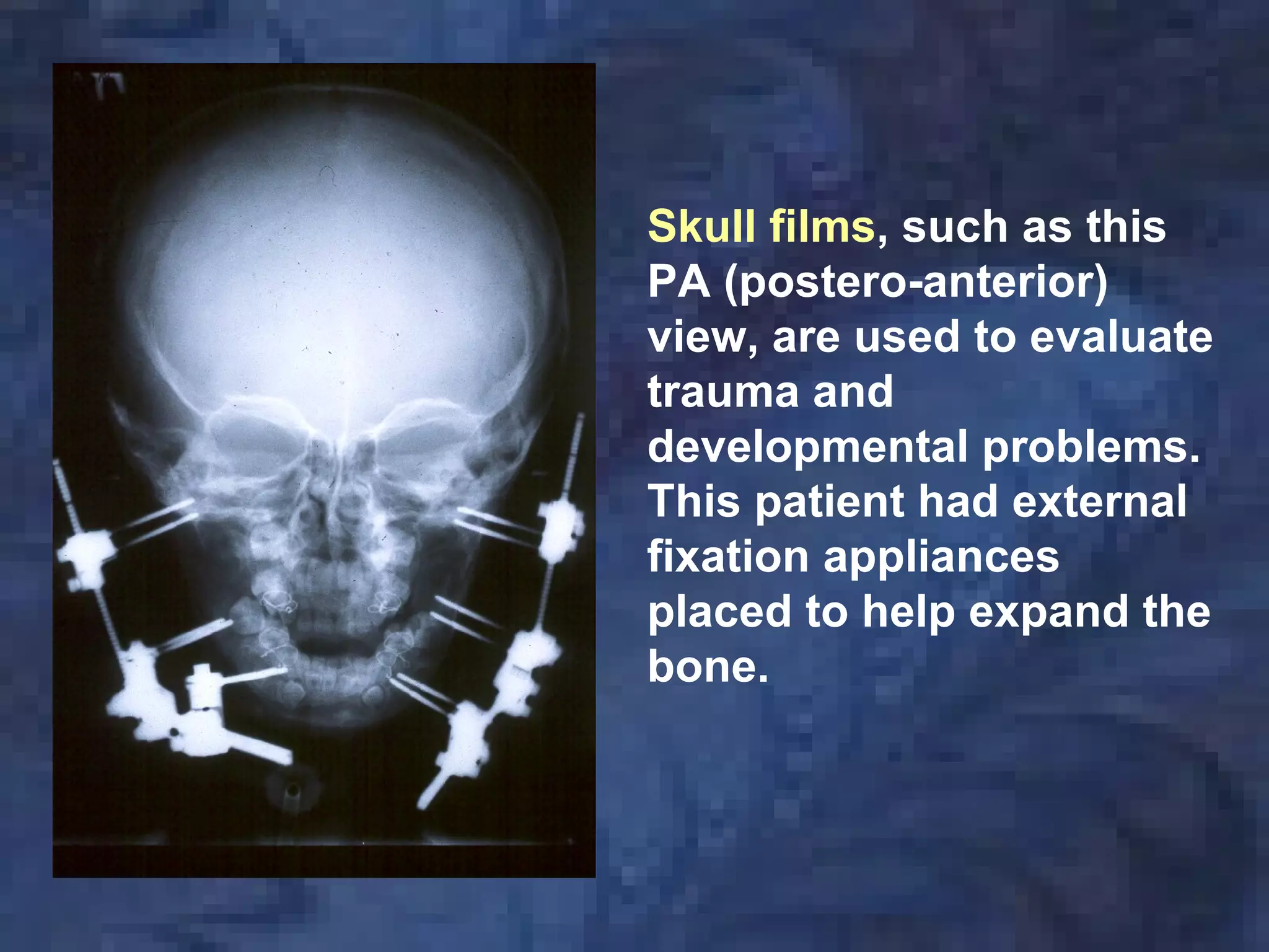 radiology-x-ray film & screens | PDF