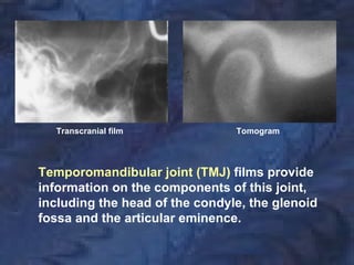 radiology-x-ray film & screens | PDF