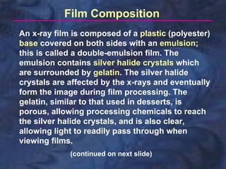 radiology-x-ray film & screens | PDF