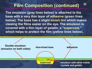 radiology-x-ray film & screens | PDF