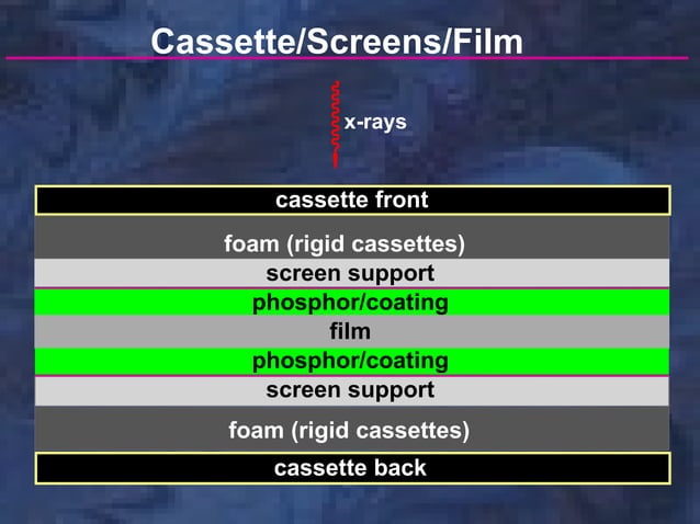 radiology-x-ray film & screens | PDF