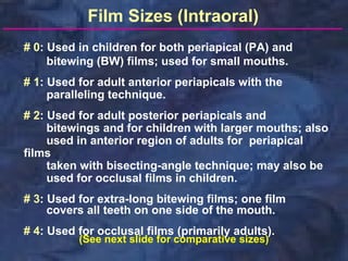 radiology-x-ray film & screens | PDF