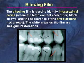 radiology-x-ray film & screens | PDF