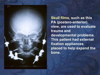radiology-x-ray film & screens | PDF