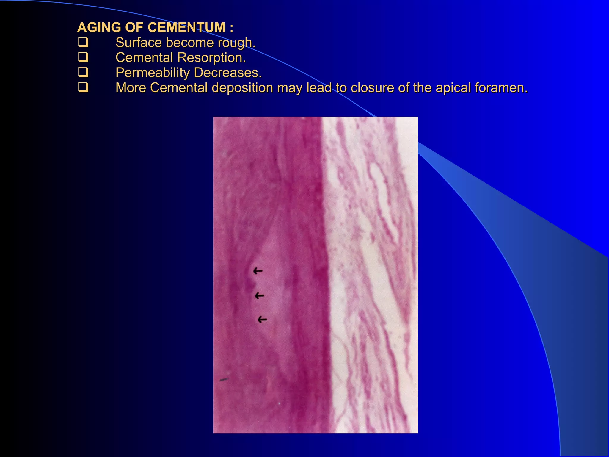 cementum | PPT