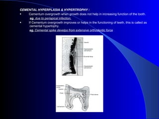 cementum | PPT