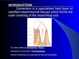 cementum | PPT
