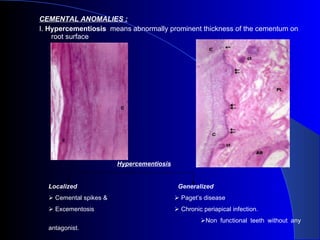 cementum | PPT