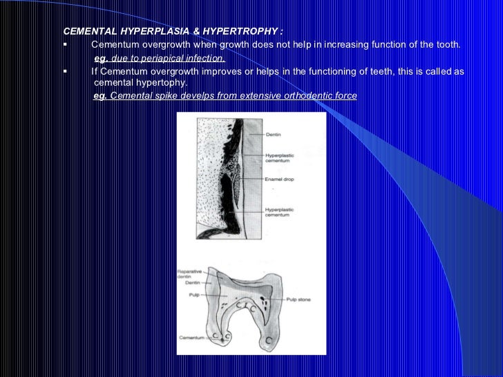 cementum