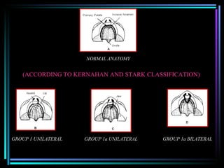 cleft-lip-palate | PPT