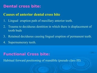 crossbite | PDF