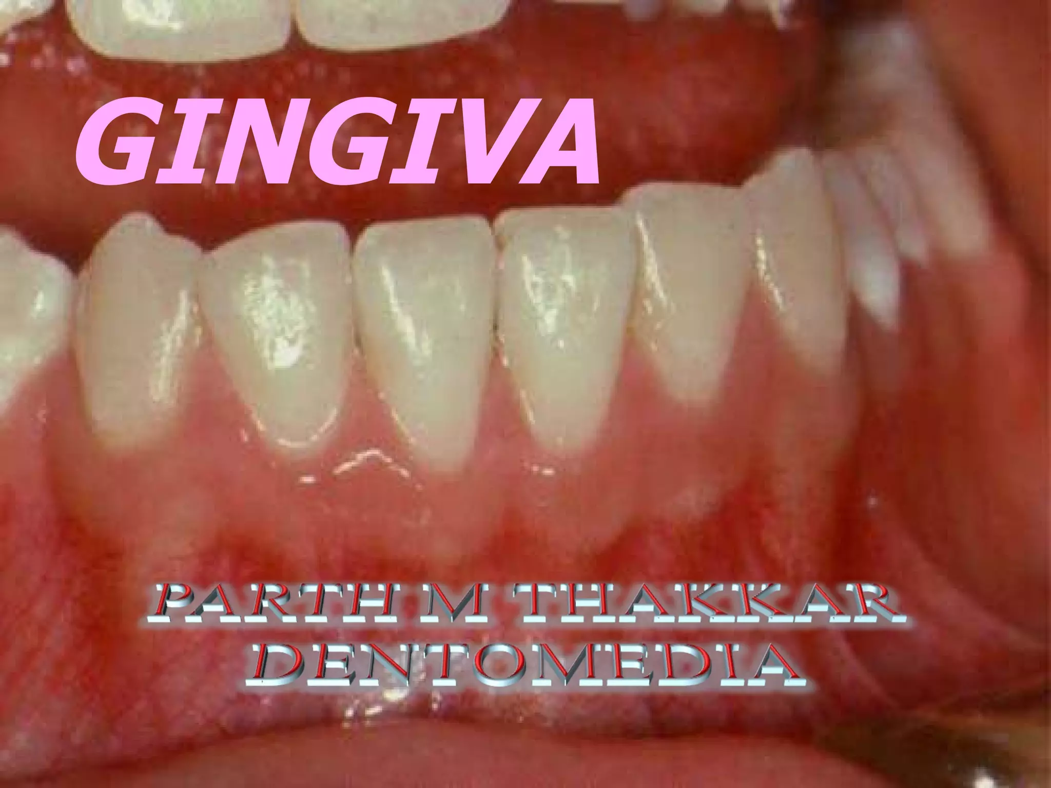 gingiva | PPT