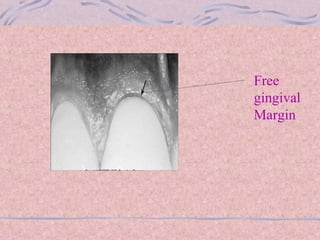 gingiva | PPT