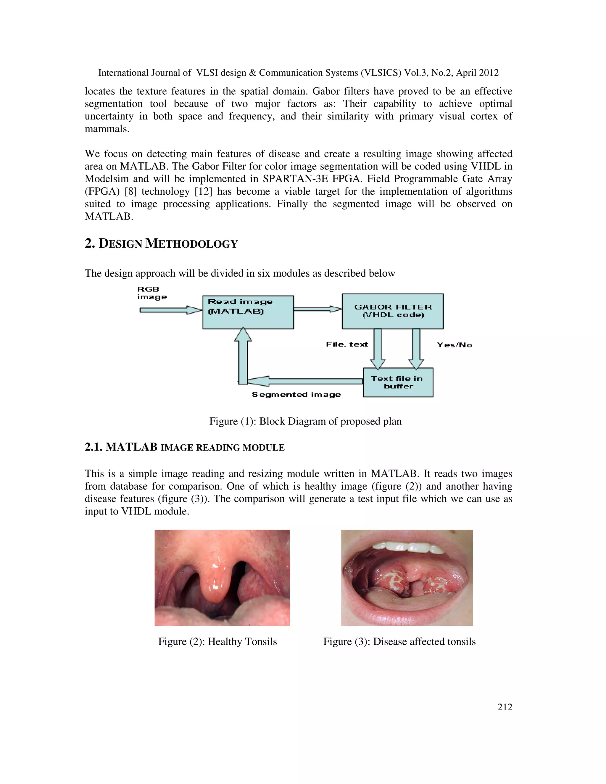 Vhdl Design For Image Segmentation Using Gabor Filter For Disease