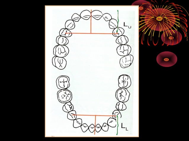 model-analysis | PDF | Dental Health | Diseases and Conditions