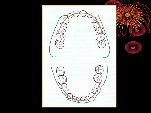 model-analysis | PDF | Dental Health | Diseases and Conditions