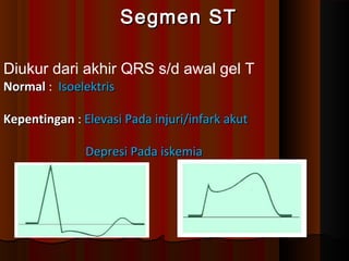 perekaman-ekg-bu-resminar-1-ppt | PPT