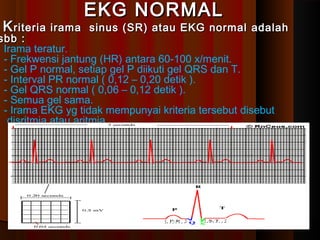 perekaman-ekg-bu-resminar-1-ppt | PPT