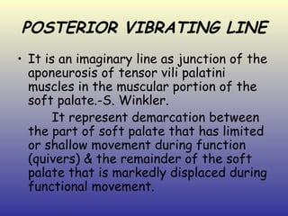 Vibrating Line