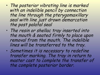Vibrating Line
