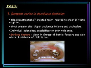 rampant caries | PPT