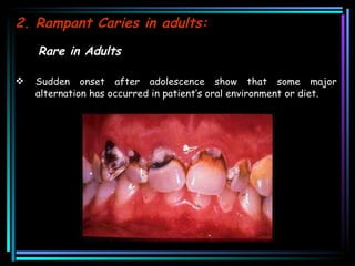Rampant Caries