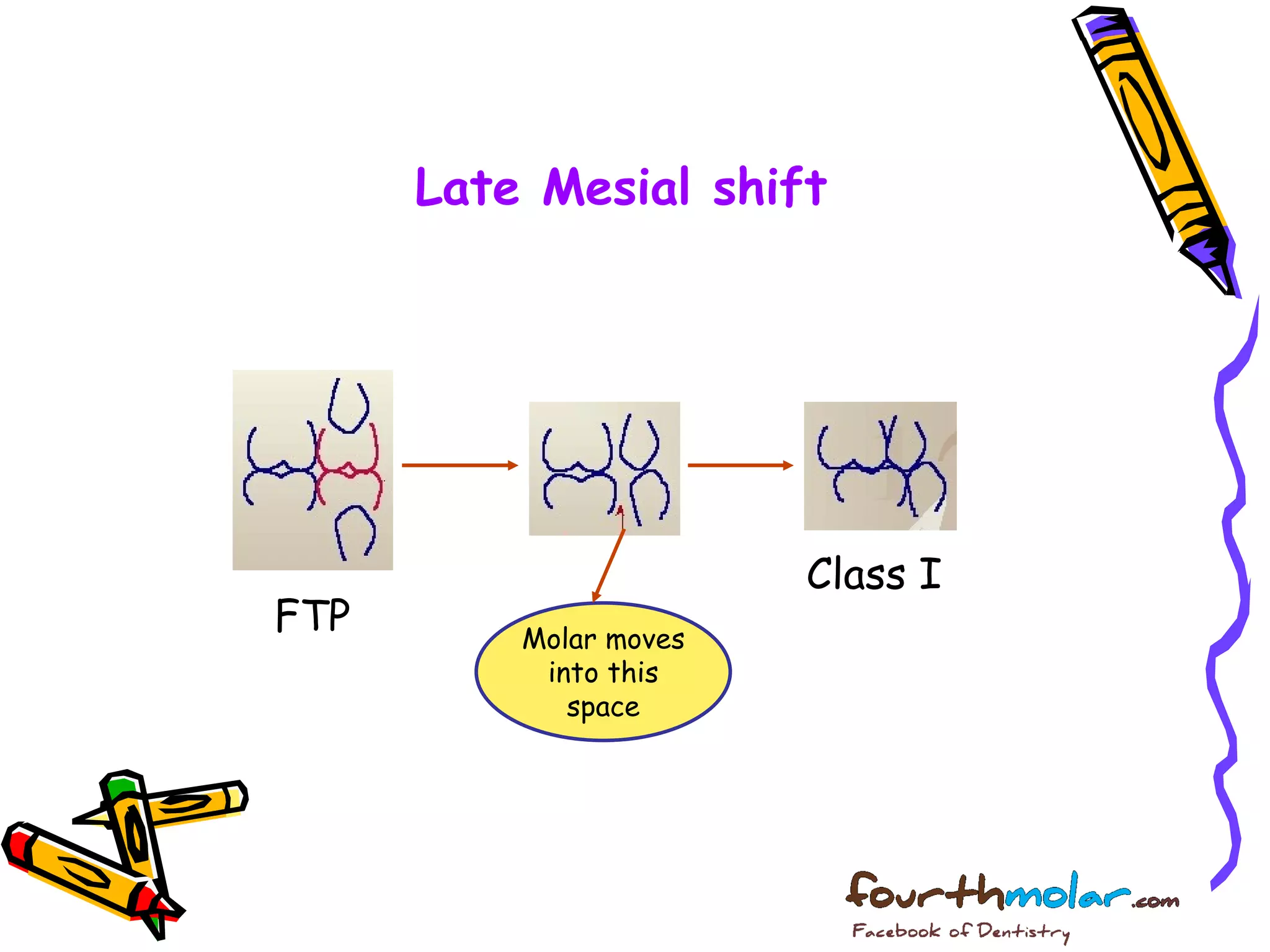 the-mixed-dentition-pedodontics | PPT