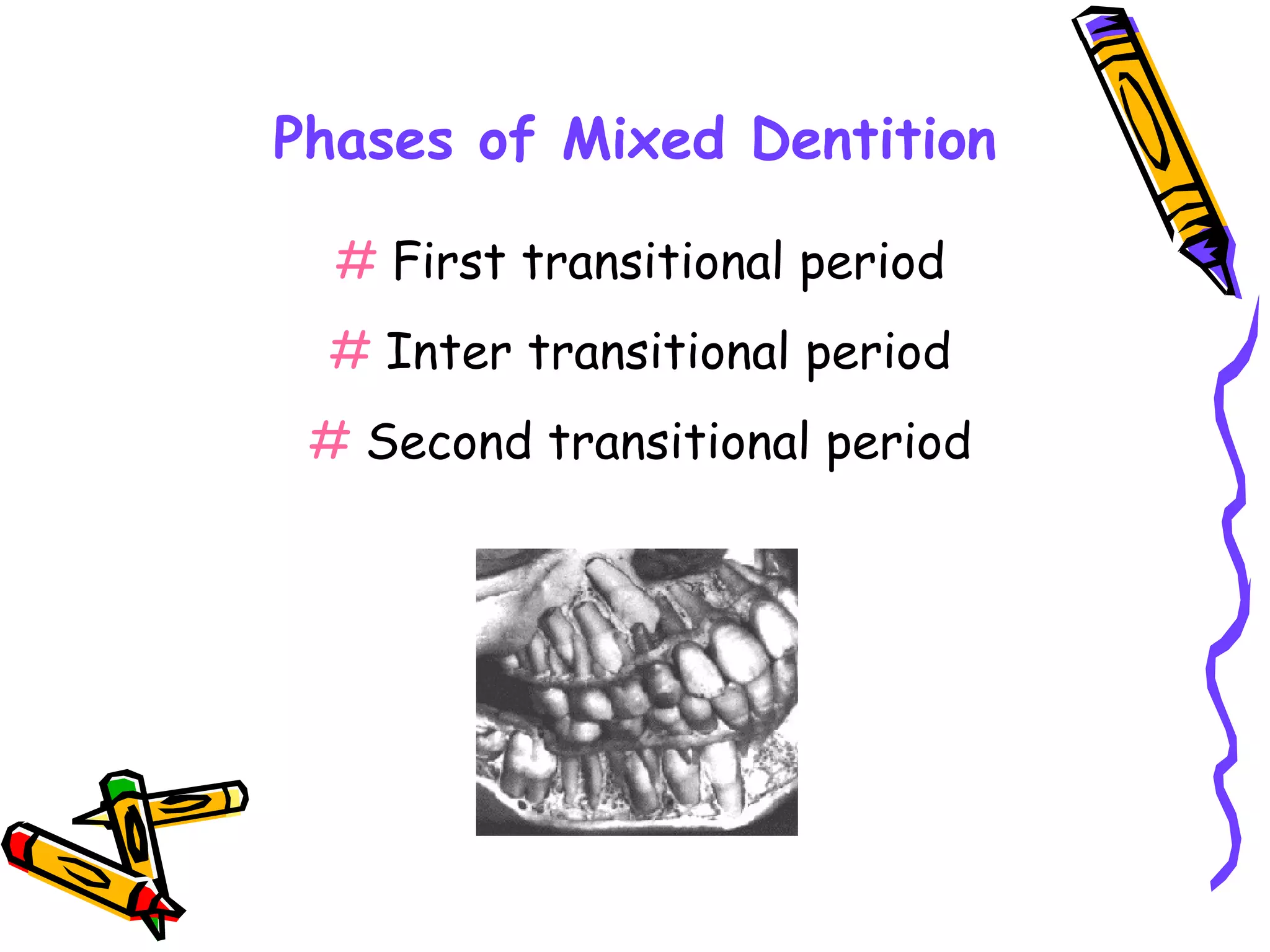 the-mixed-dentition-pedodontics | PPT