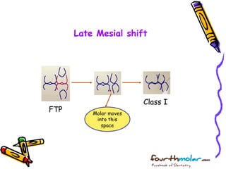 the-mixed-dentition-pedodontics | PPT
