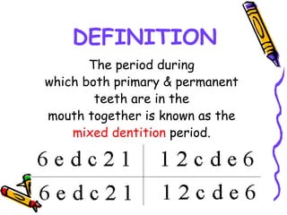 the-mixed-dentition-pedodontics | PPT