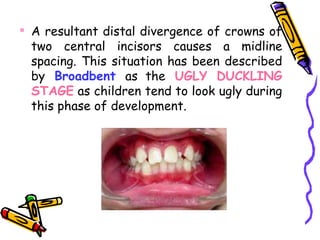 the-mixed-dentition-pedodontics | PPT