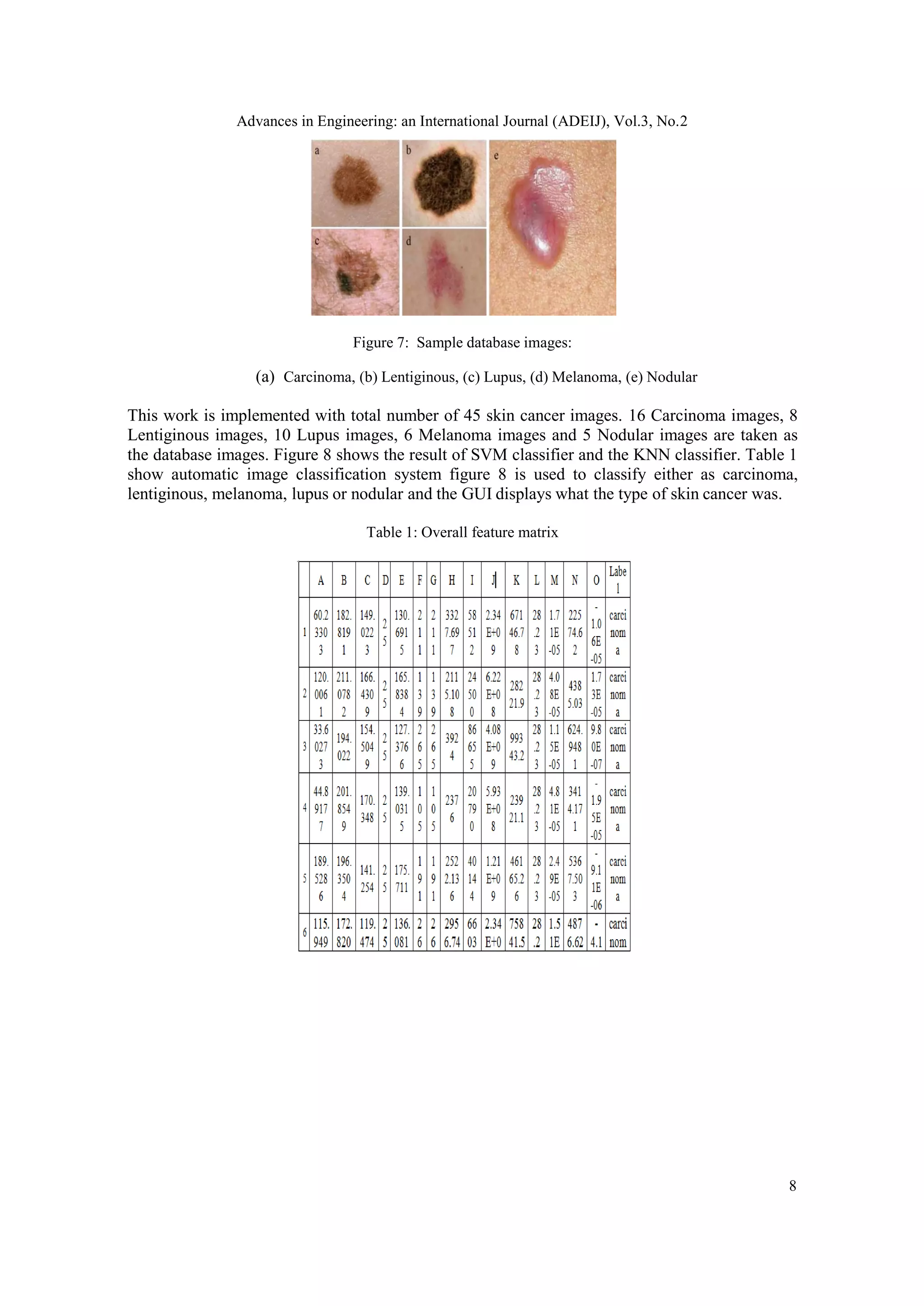 DETECTION OF LESION USING SVM | PDF