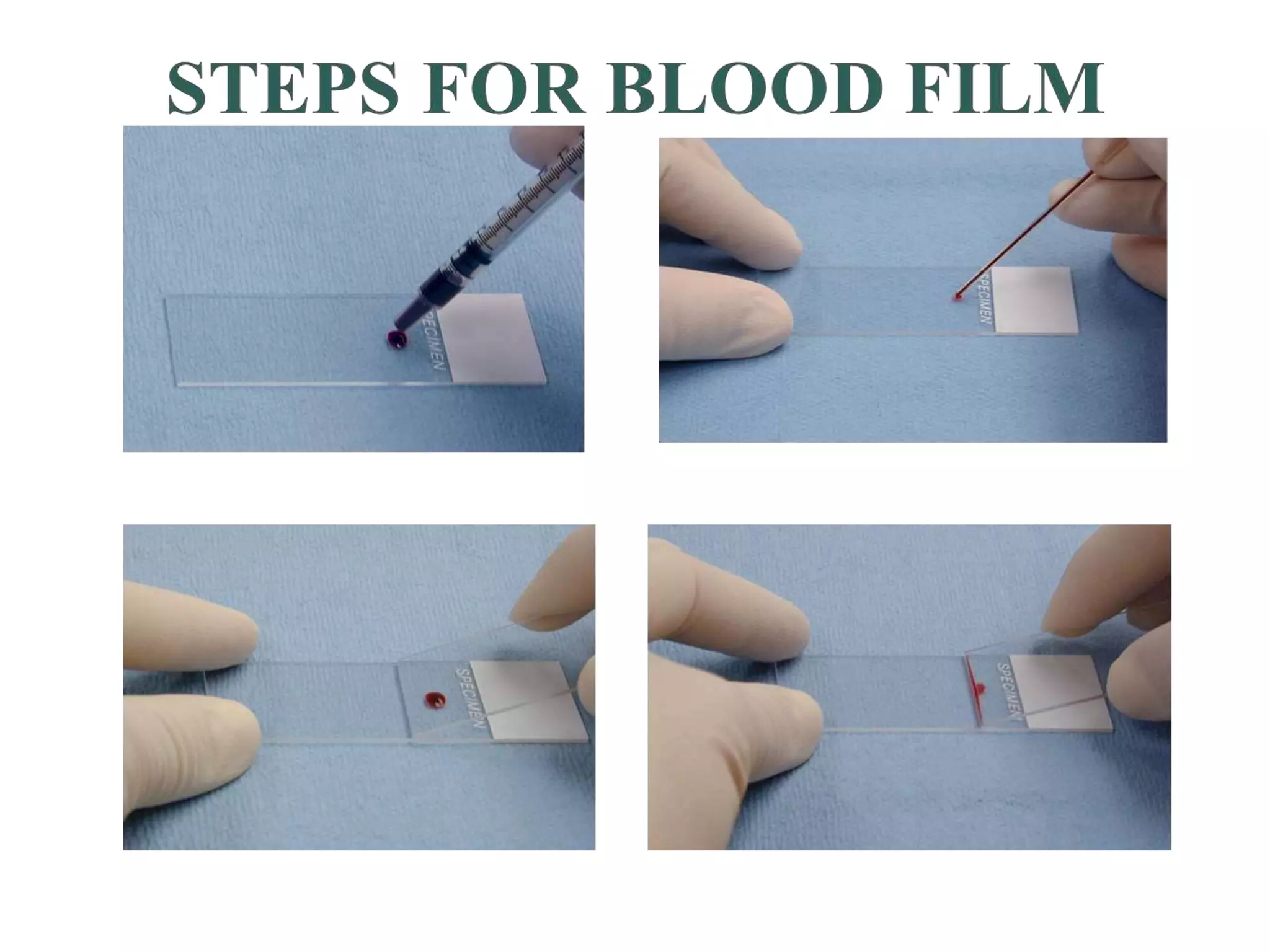 special and routine stains in haematology 1 | PPTX
