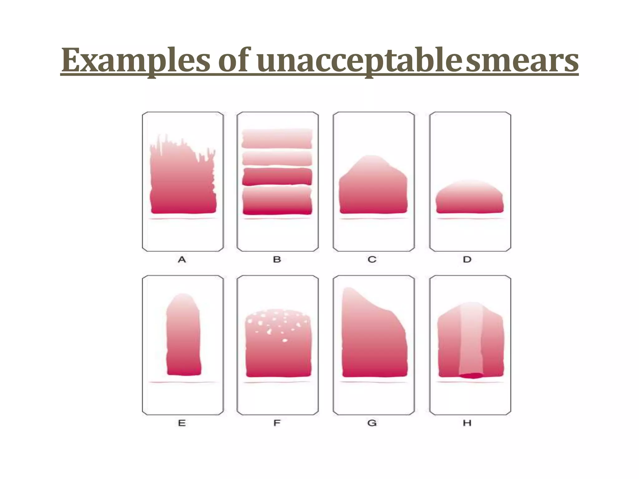 special and routine stains in haematology 1 | PPTX
