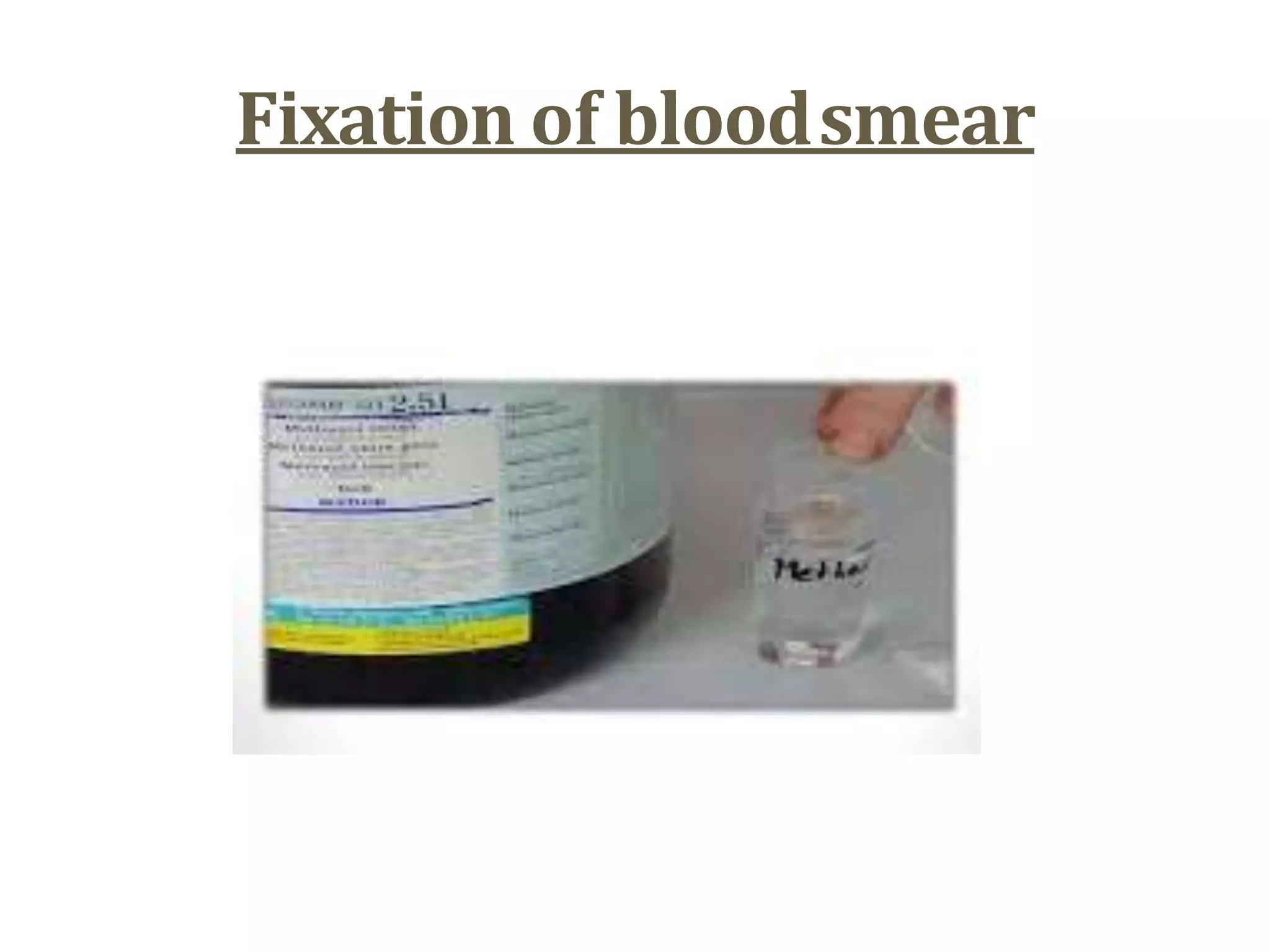 special and routine stains in haematology 1 | PPTX