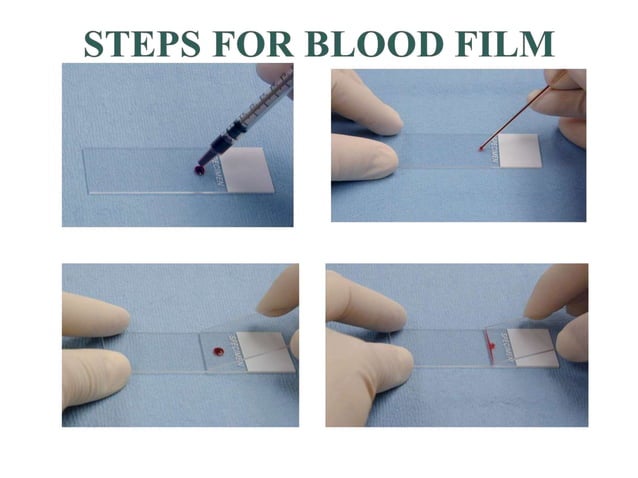 special and routine stains in haematology 1 | PPTX | Blood Disorders ...