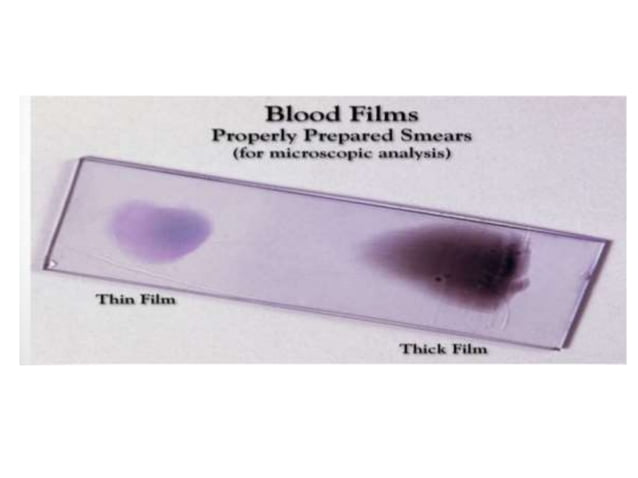 special and routine stains in haematology 1 | PPTX | Blood Disorders ...