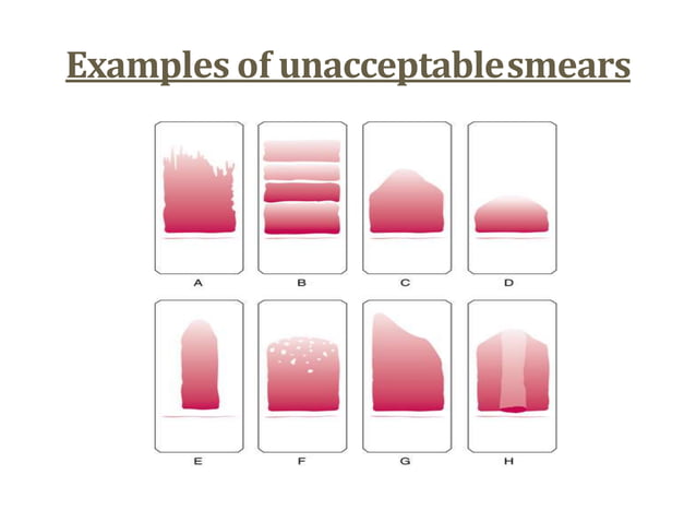 special and routine stains in haematology 1 | PPTX | Blood Disorders ...