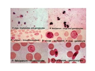 special and routine stains in haematology 1 | PPTX