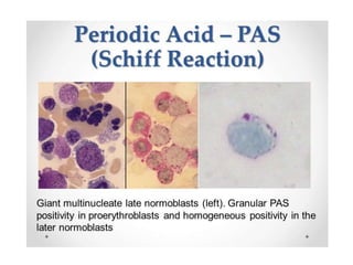 special and routine stains in haematology 1 | PPTX