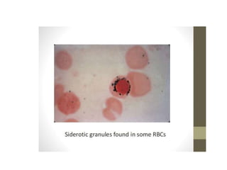 special and routine stains in haematology 1 | PPTX
