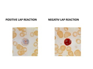 special and routine stains in haematology 1 | PPTX