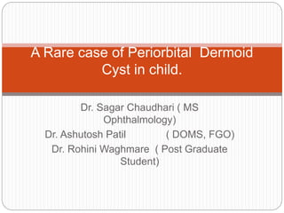 A Rare Case Of Periorbital Dermoid Cyst In Child. | PPTX