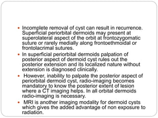 A Rare Case Of Periorbital Dermoid Cyst In Child. | PPTX
