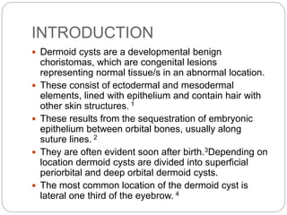 A Rare Case Of Periorbital Dermoid Cyst In Child. | PPT