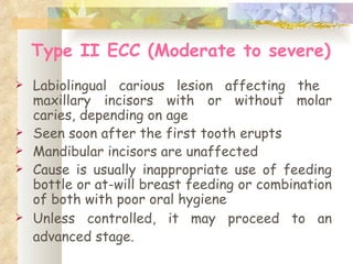 nursing-caries-pedo | PPT