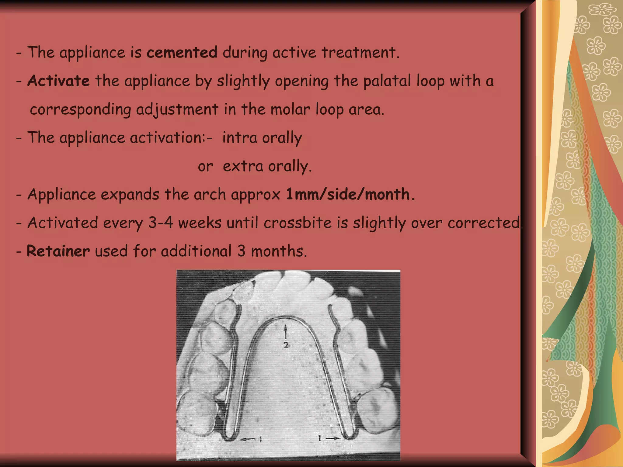 posterior crossbite in primary and mixed dentition etiology and ...