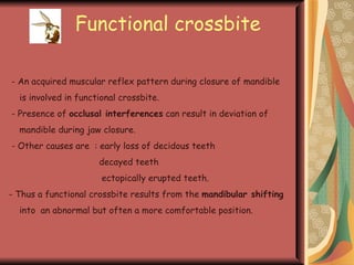 posterior crossbite in primary and mixed dentition etiology and ...